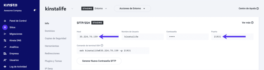 Cómo Usar Bedrock y Trellis en Kinsta (Desarrollo de WordPress)